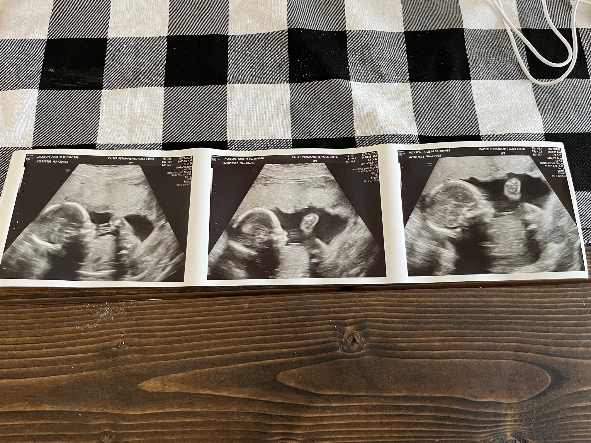 The Anatomy Scan – IVF That